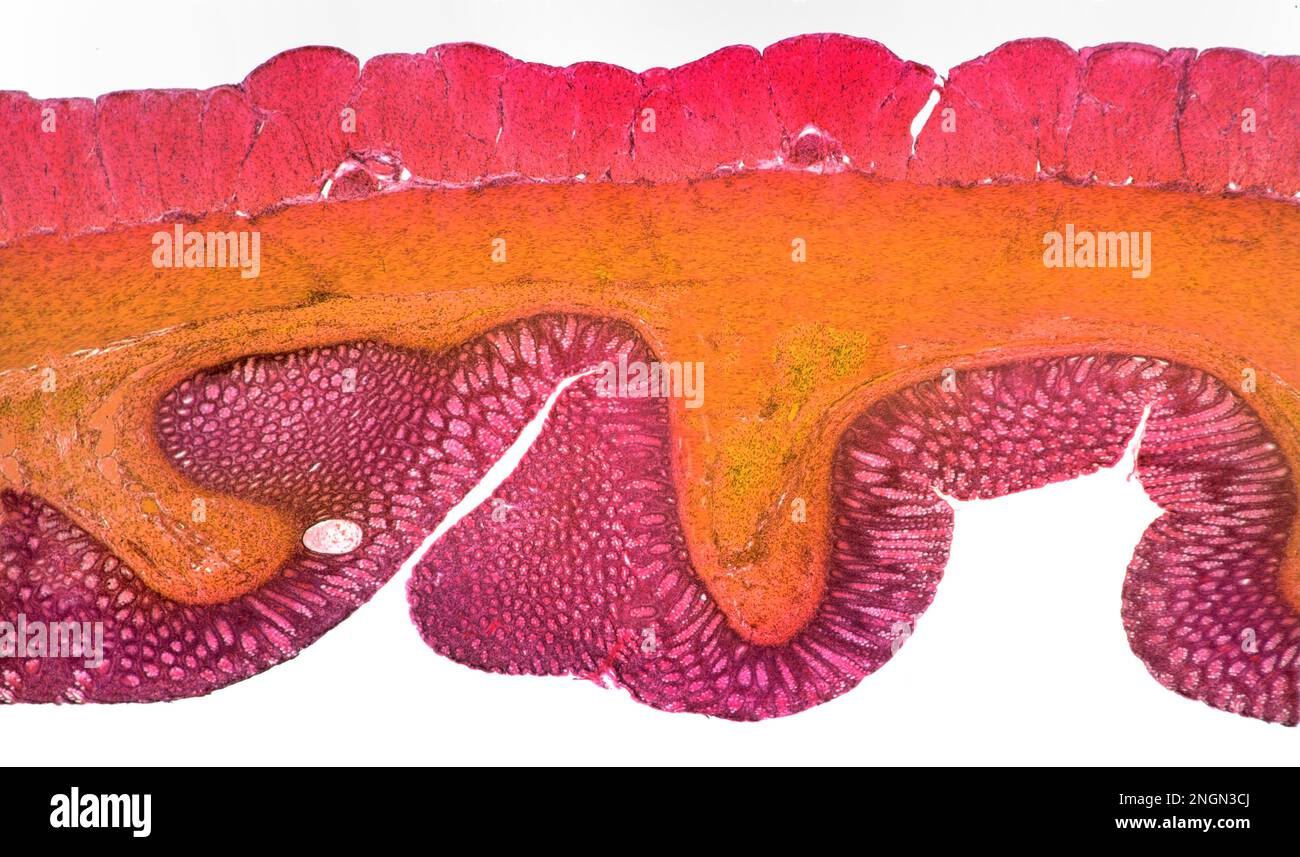 Anatomie du colon Banque de photographies et d’images à haute ...