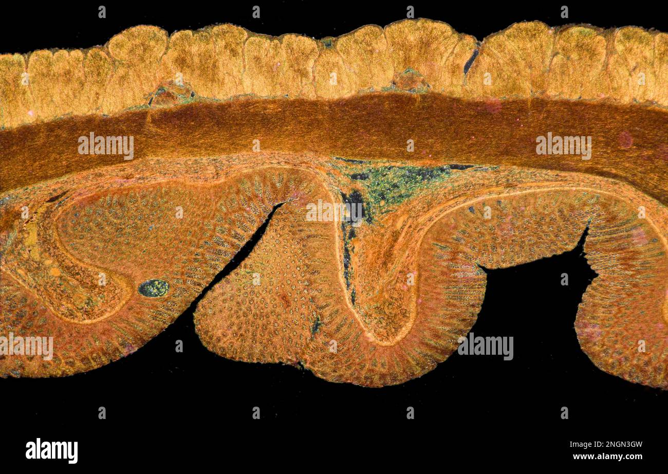 Colon humain Banque de photographies et d’images à haute résolution - Alamy