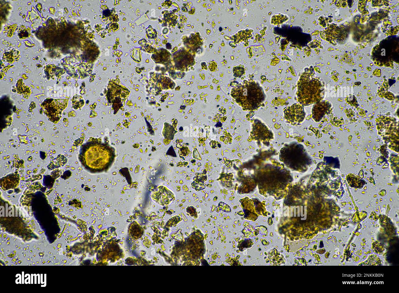 micro-organismes du sol dans un échantillon de sol, champignon du sol ...