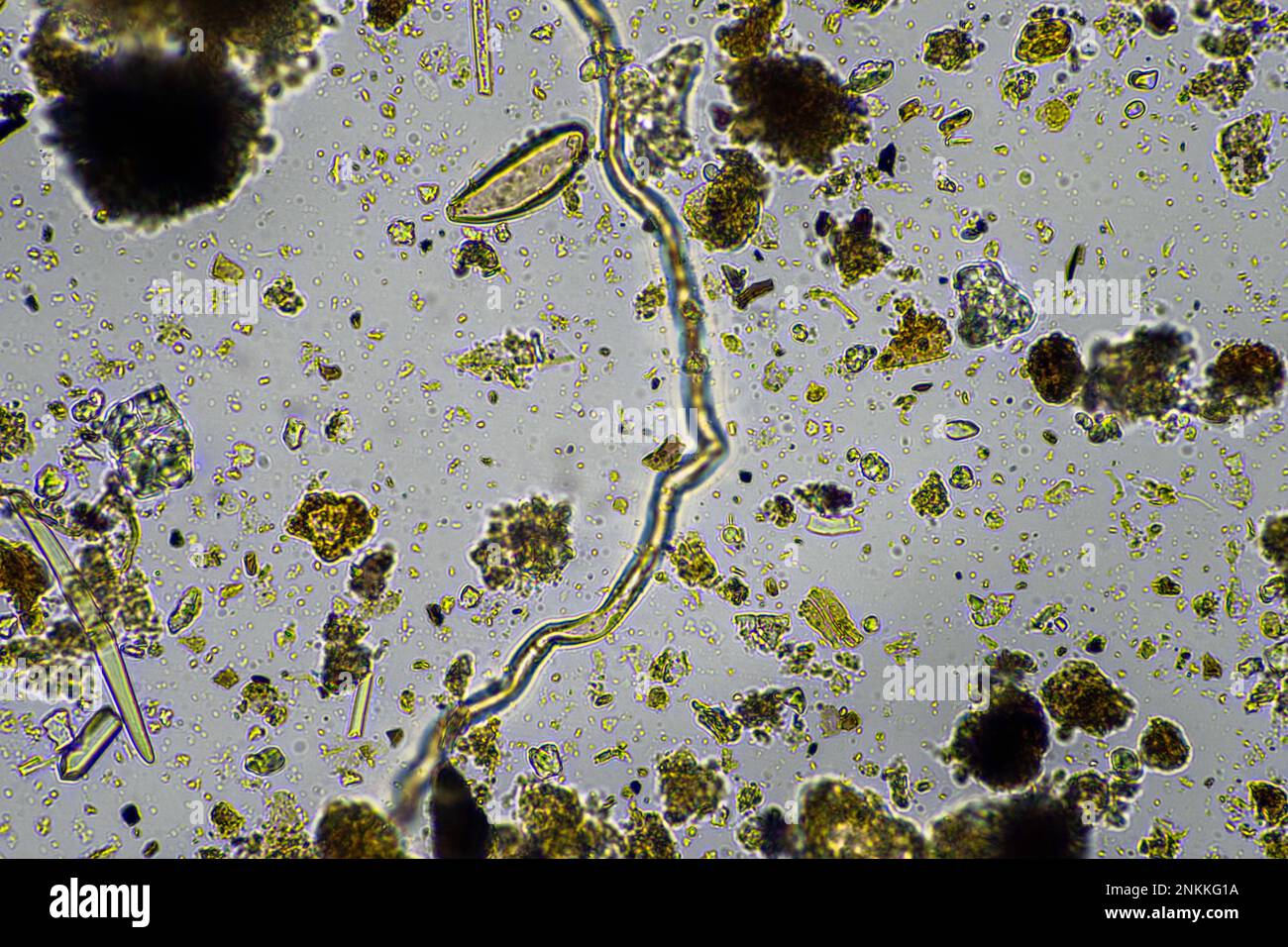 micro-organismes du sol dans un échantillon de sol, champignon du sol ...