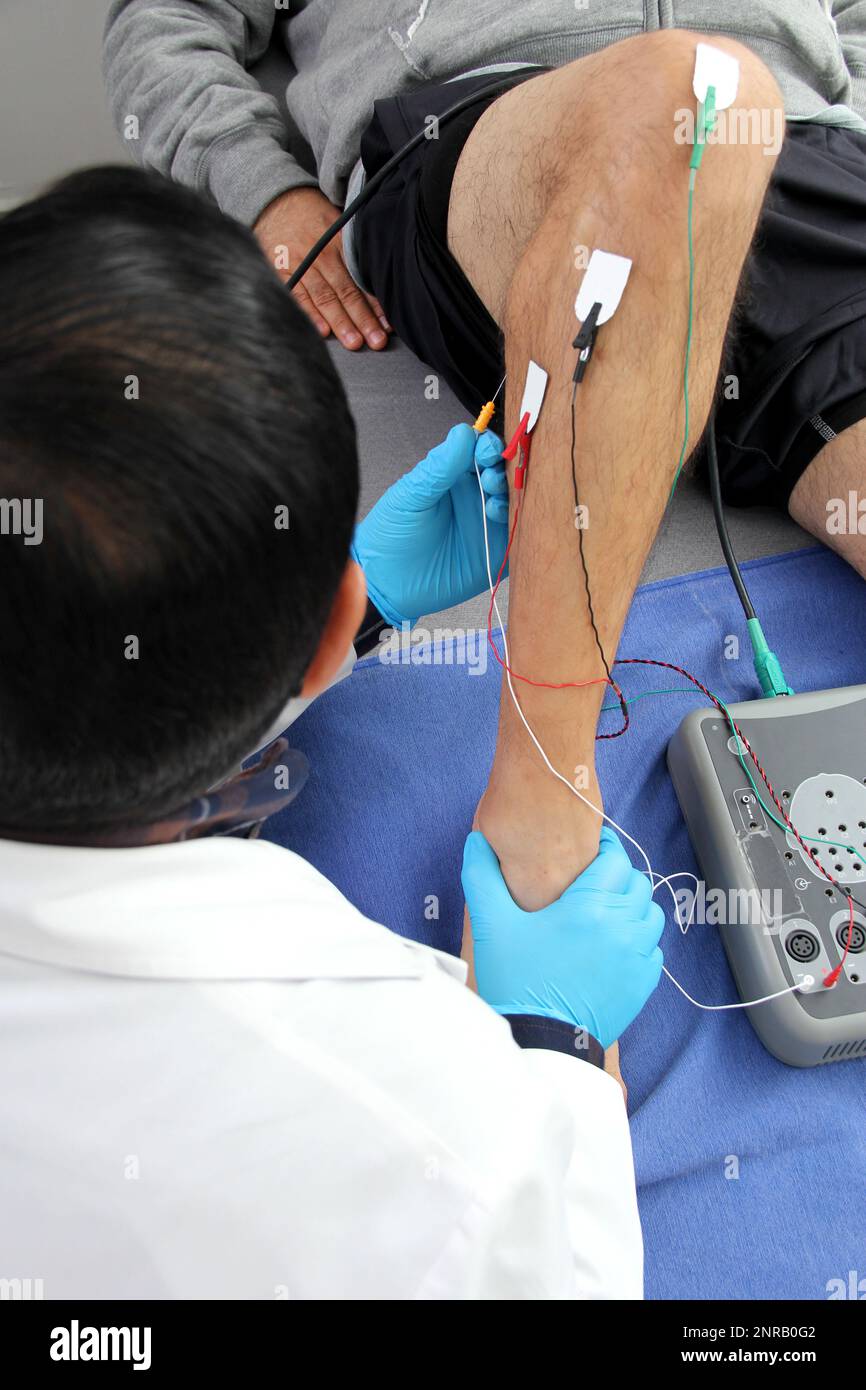Électromyographie EMG et Somatosensory potentiel évoqué de la VEP des ...