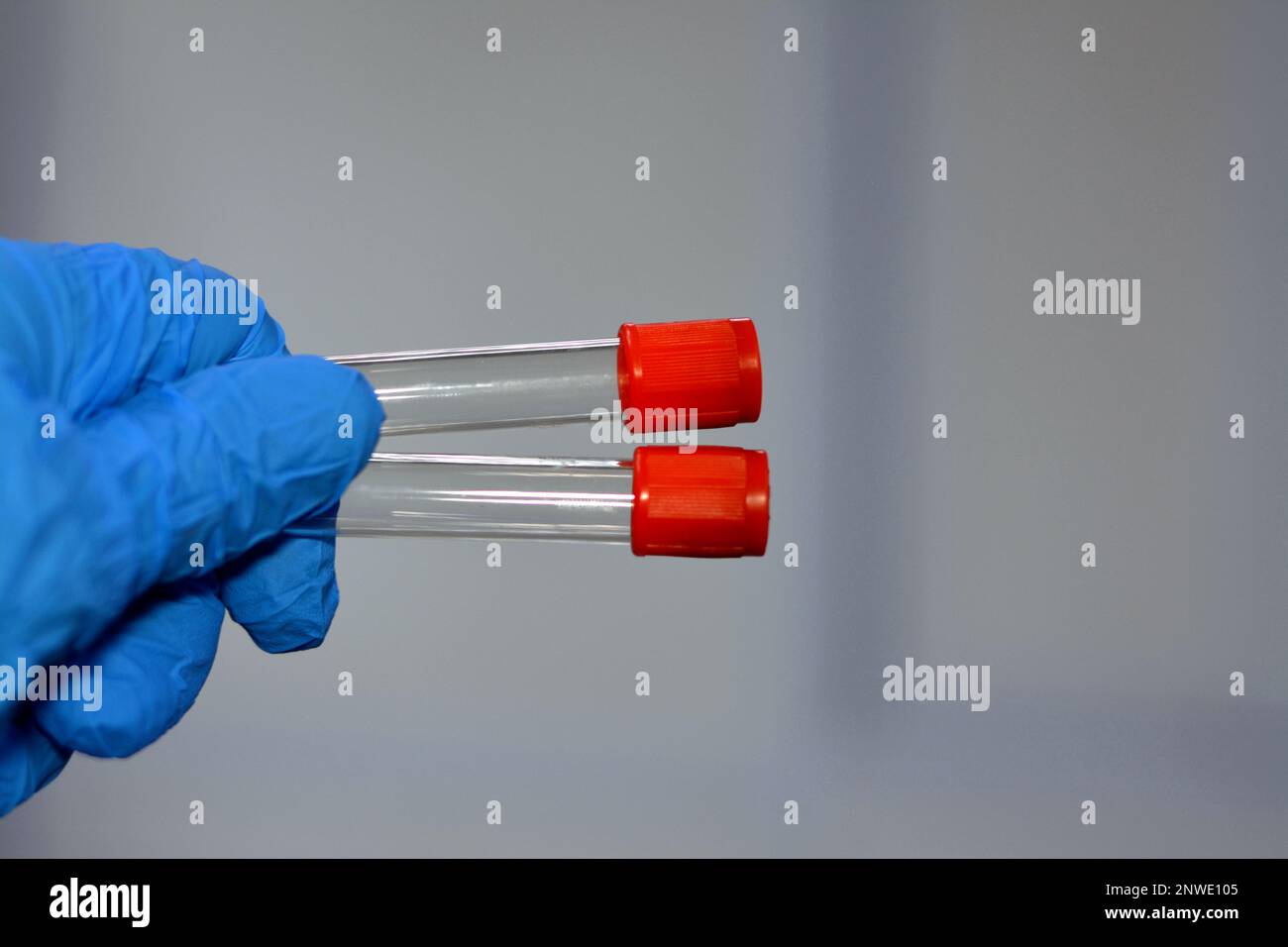 Tube de prélèvement sanguin pour le prélèvement d'échantillons sanguins ...