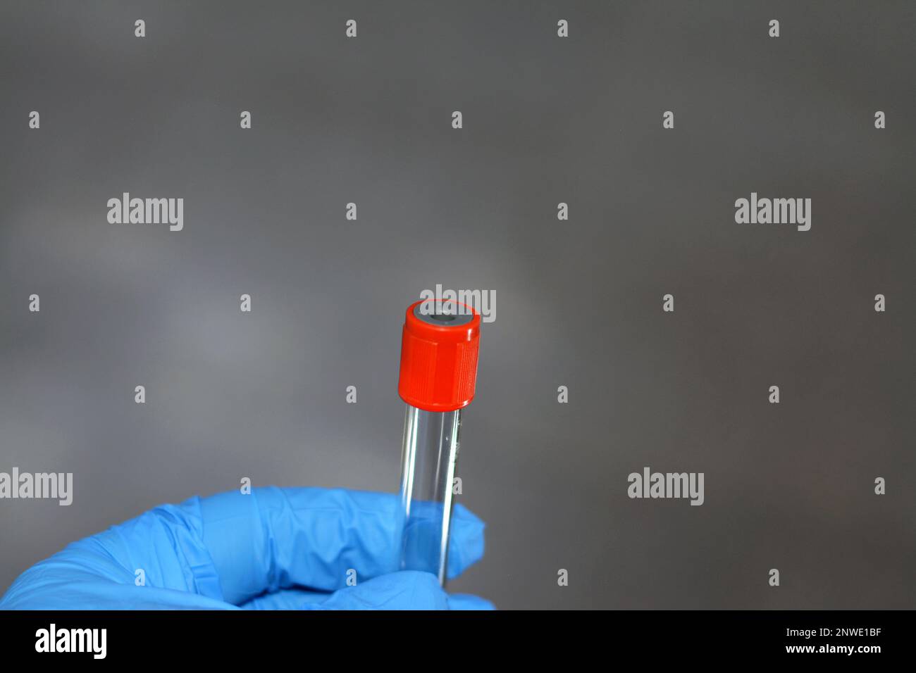 Tube de prélèvement sanguin pour le prélèvement d'échantillons sanguins ...