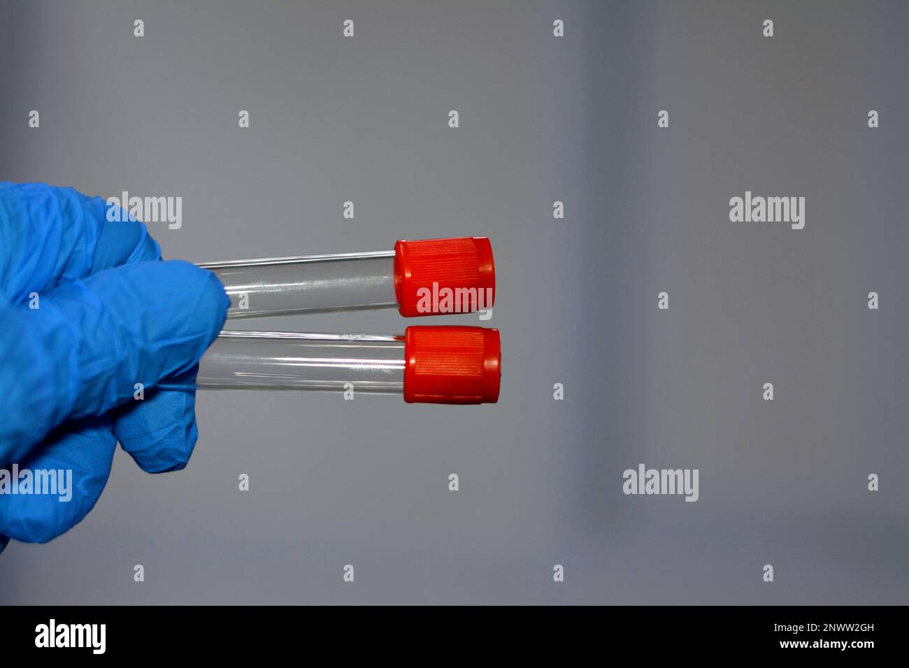 Tube de prélèvement sanguin pour le prélèvement d'échantillons sanguins ...