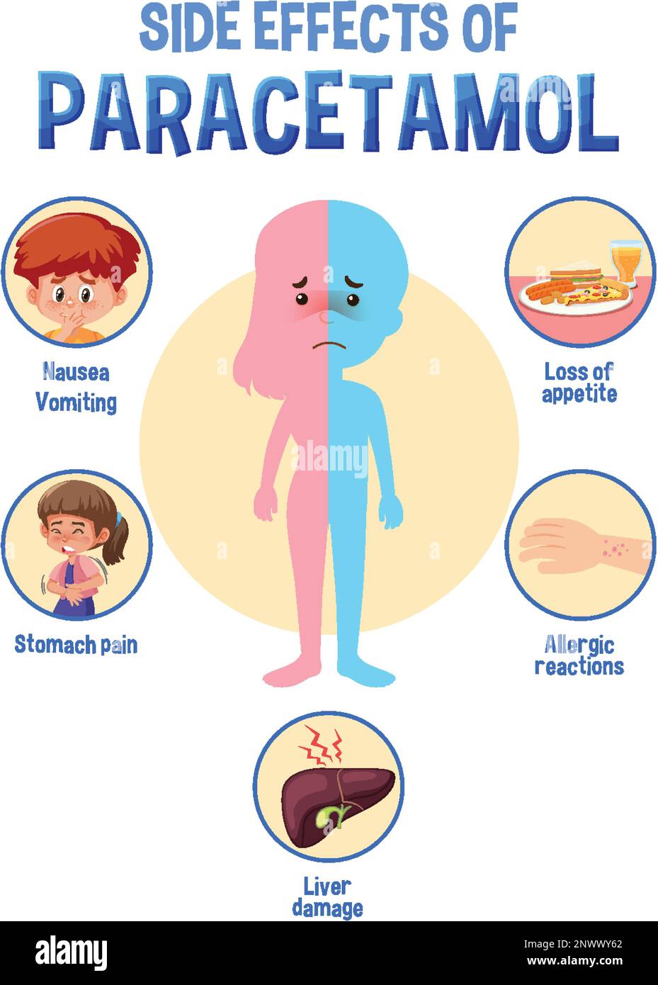 Illustration des effets secondaires du paracétamol : schéma de l ...