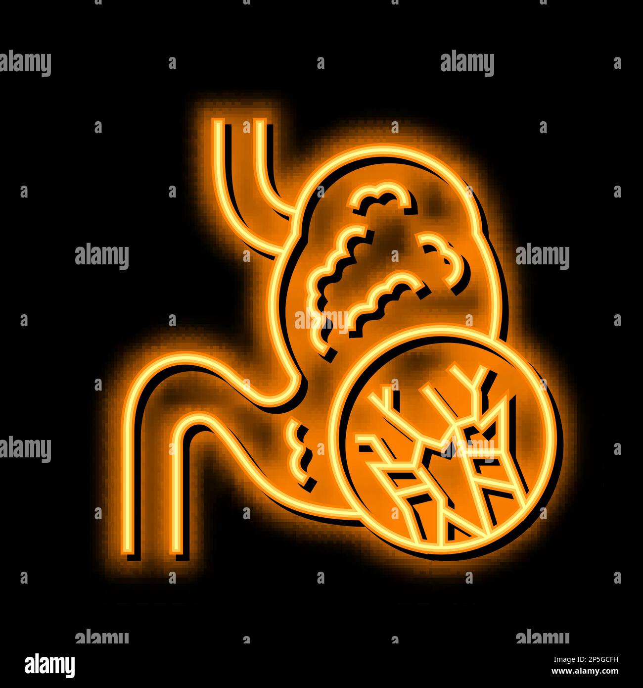 Gonflement abdominal Banque de photographies et d’images à haute ...