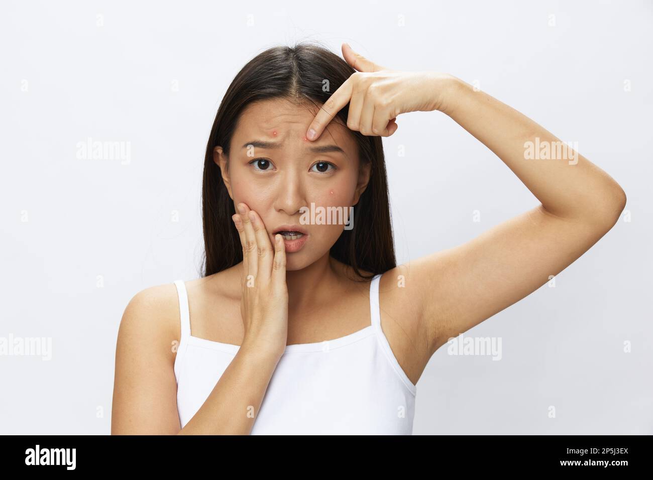 Femme asiatique problèmes de peau faciale, acné et inflammation ...