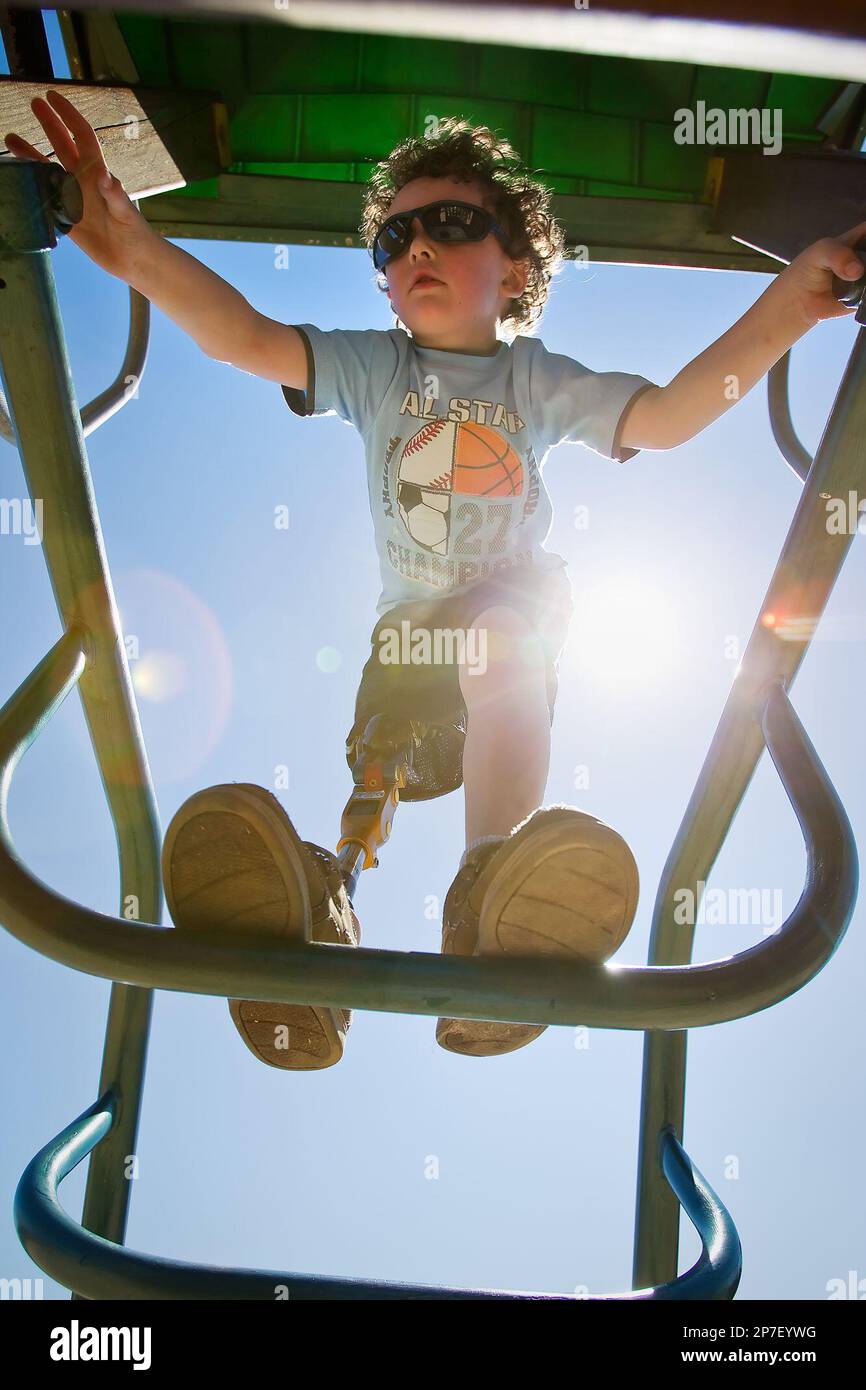 Anthony Rankin doesn't let a prosthetic leg slow him down as the 5-year ...