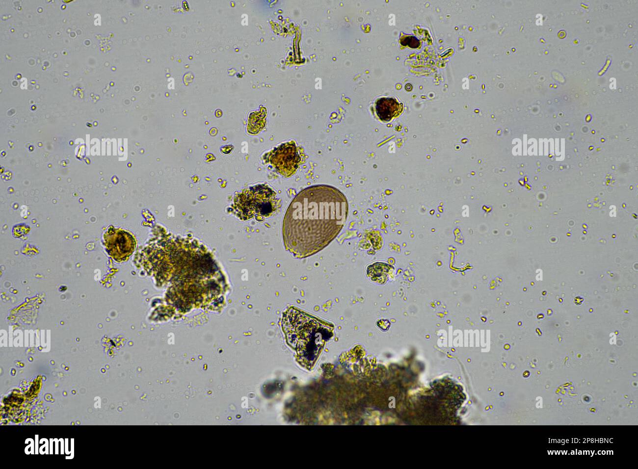 champignons du sol, micro-organismes et nématodes dans un échantillon ...