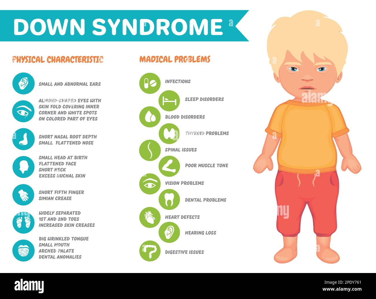 Affiche d'infographie sur les symptômes du syndrome de Down Image ...