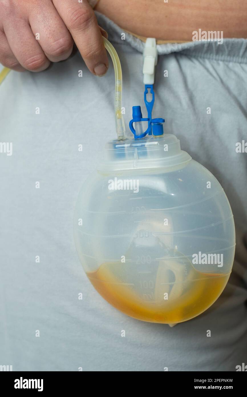 Drain chirurgical Banque de photographies et d’images à haute ...