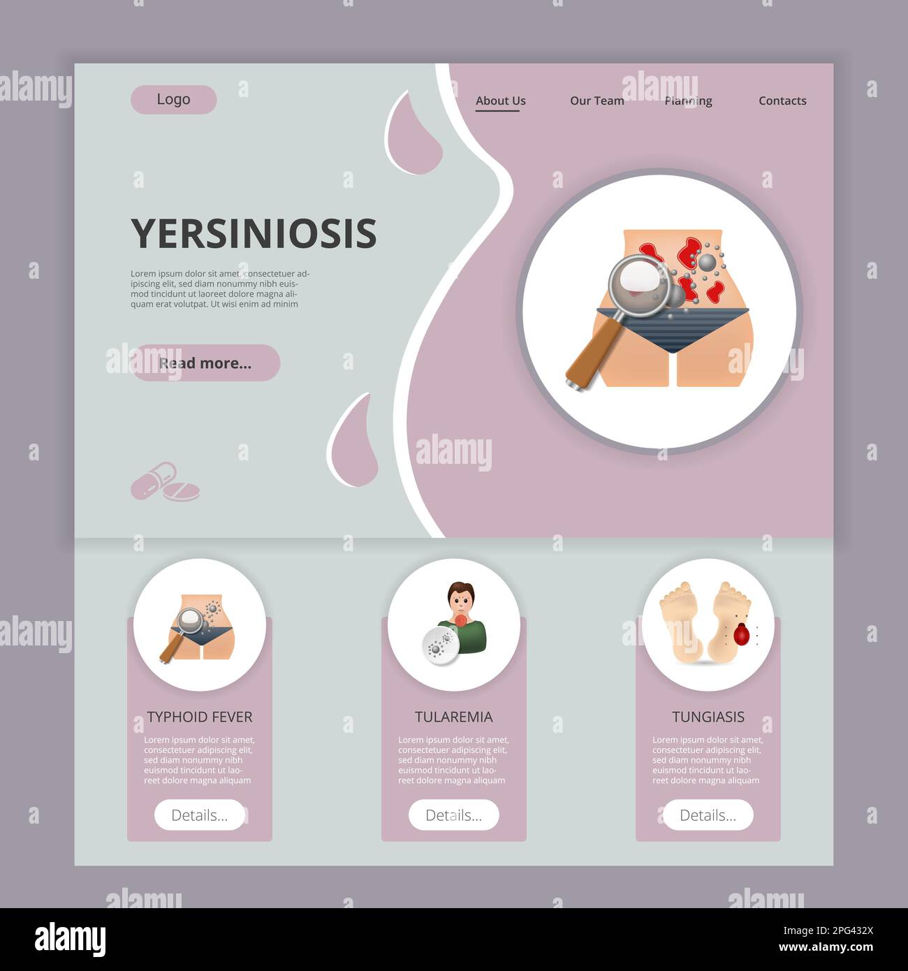 Disease typhoid Banque d'images vectorielles - Alamy