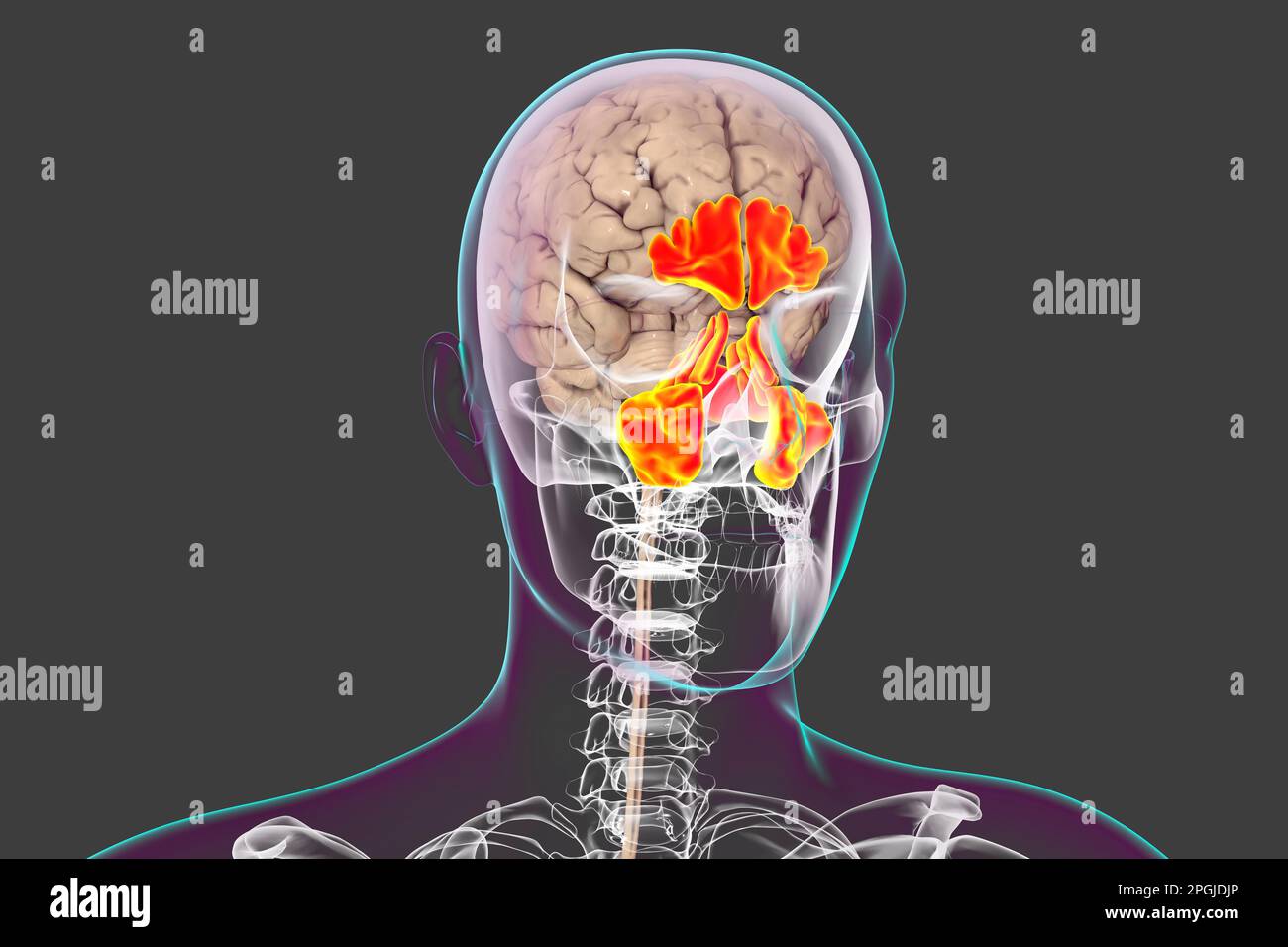 Sinus paranasaux Banque de photographies et d’images à haute résolution ...