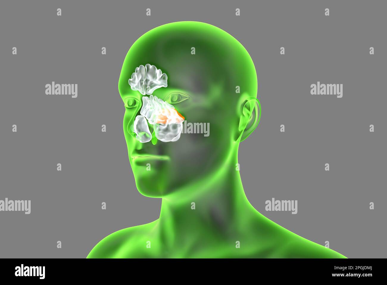 Sinus paranasaux humains, illustration informatique. Les sinus sont des ...