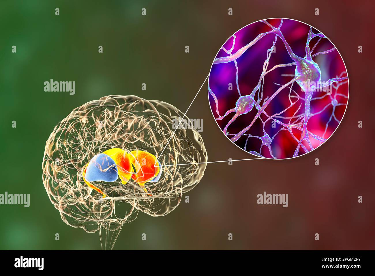 Striatum dorsal dans le cerveau et vue rapprochée de ses neurones ...