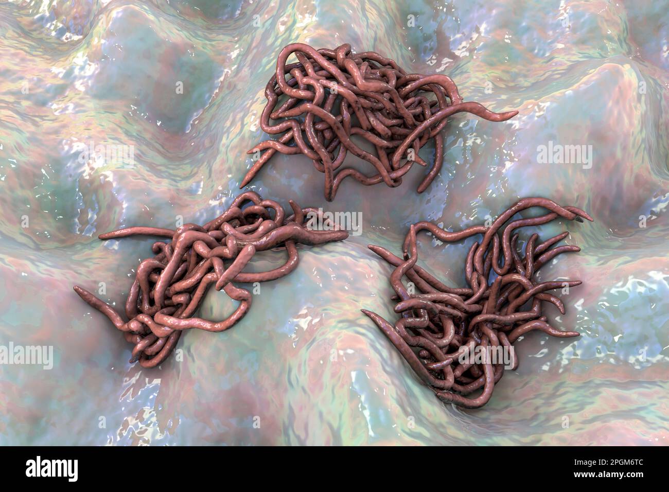 Vers intestinaux humains Banque de photographies et d’images à haute ...