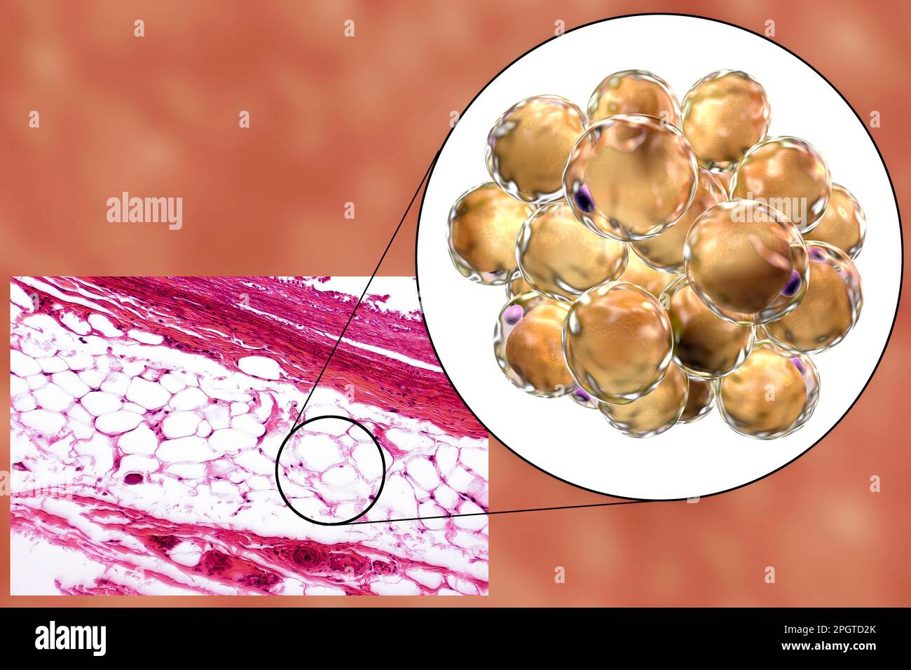 Cellules graisseuses, micrographe léger et illustration informatique ...