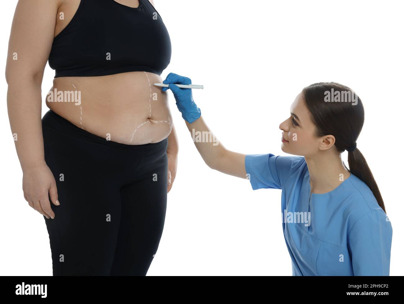 Le médecin dessine des marques sur le corps de la femme obèse sur fond ...