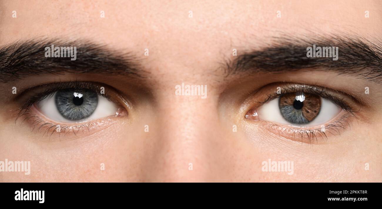 Heterochromia iris Banque de photographies et d’images à haute ...