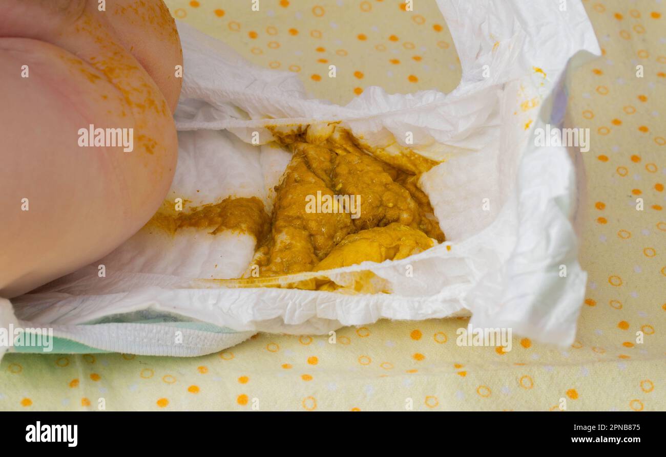 Couche sale Banque de photographies et d’images à haute résolution - Alamy