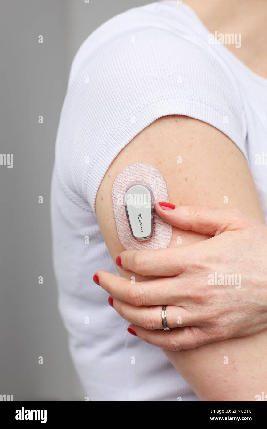 Dexcom g6 Banque de photographies et d’images à haute résolution - Alamy