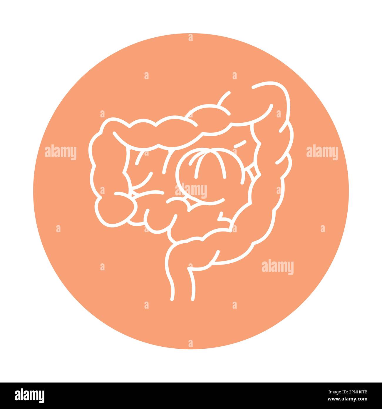 Une occlusion intestinale Banque d'images vectorielles - Alamy