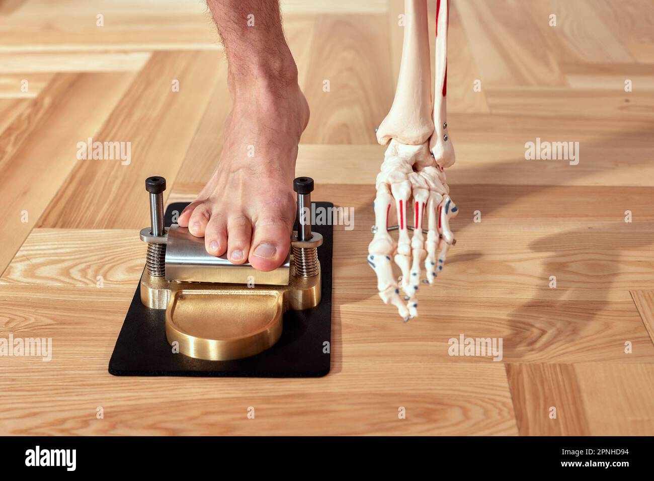 Diagnostic de pieds plats jambe humaine et squelette médical et ...