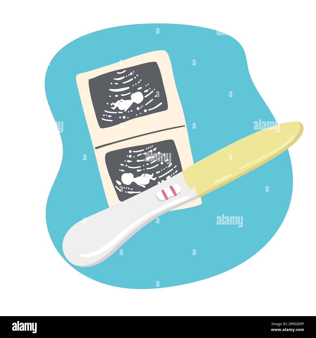 Un résultat positif au test de grossesse, une photo d'un bébé sur une ...