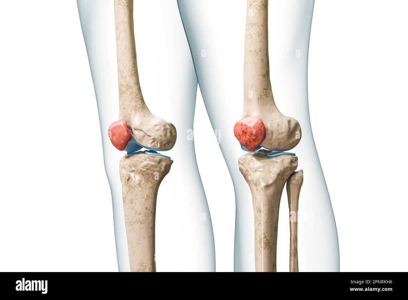 Patella ou os de genouillère de couleur rouge avec corps 3D ...