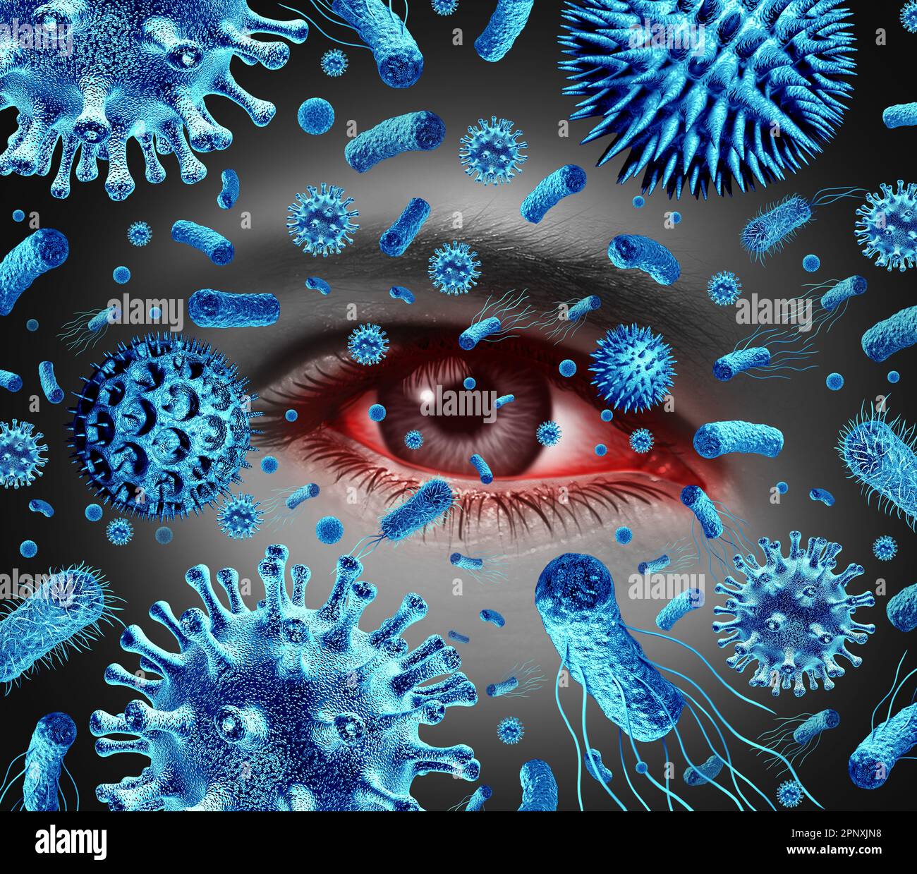 Conjonctivite infection oculaire ou infection oculaire rose comme une ...