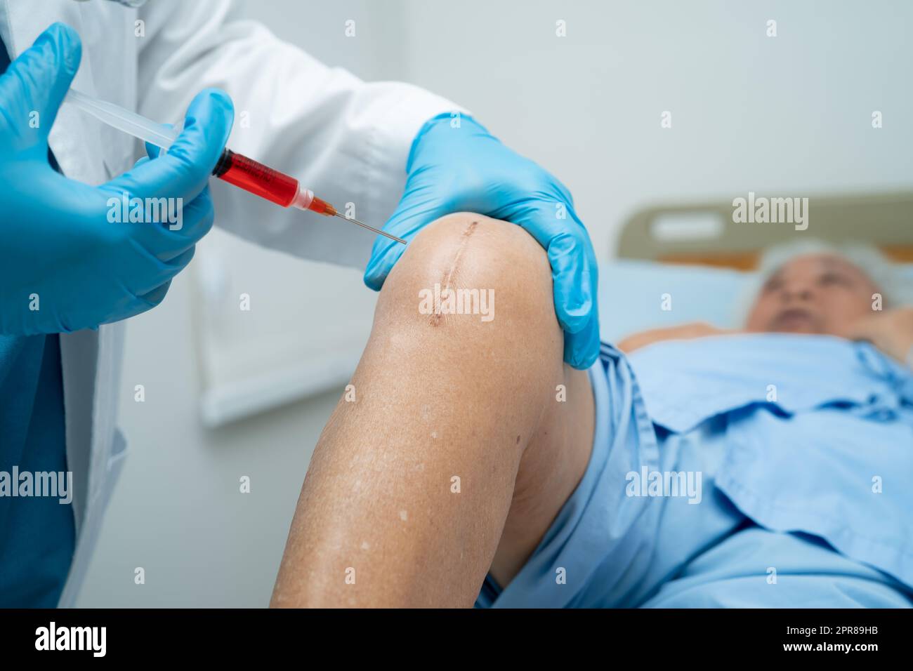 Un médecin asiatique injecte du plasma riche en plaquettes d'acide ...