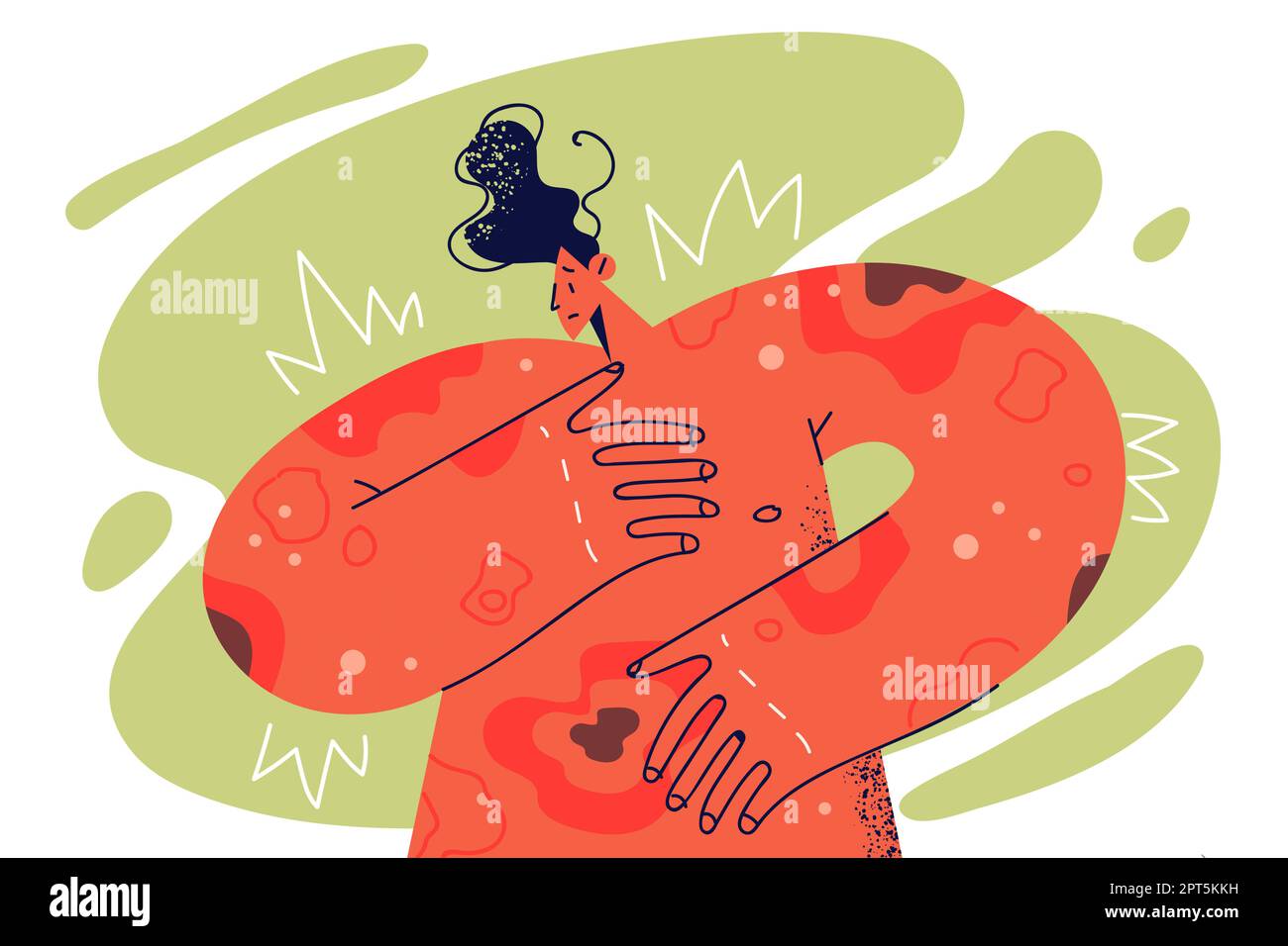 Taches rouges sur le corps Banque de photographies et d’images à haute ...