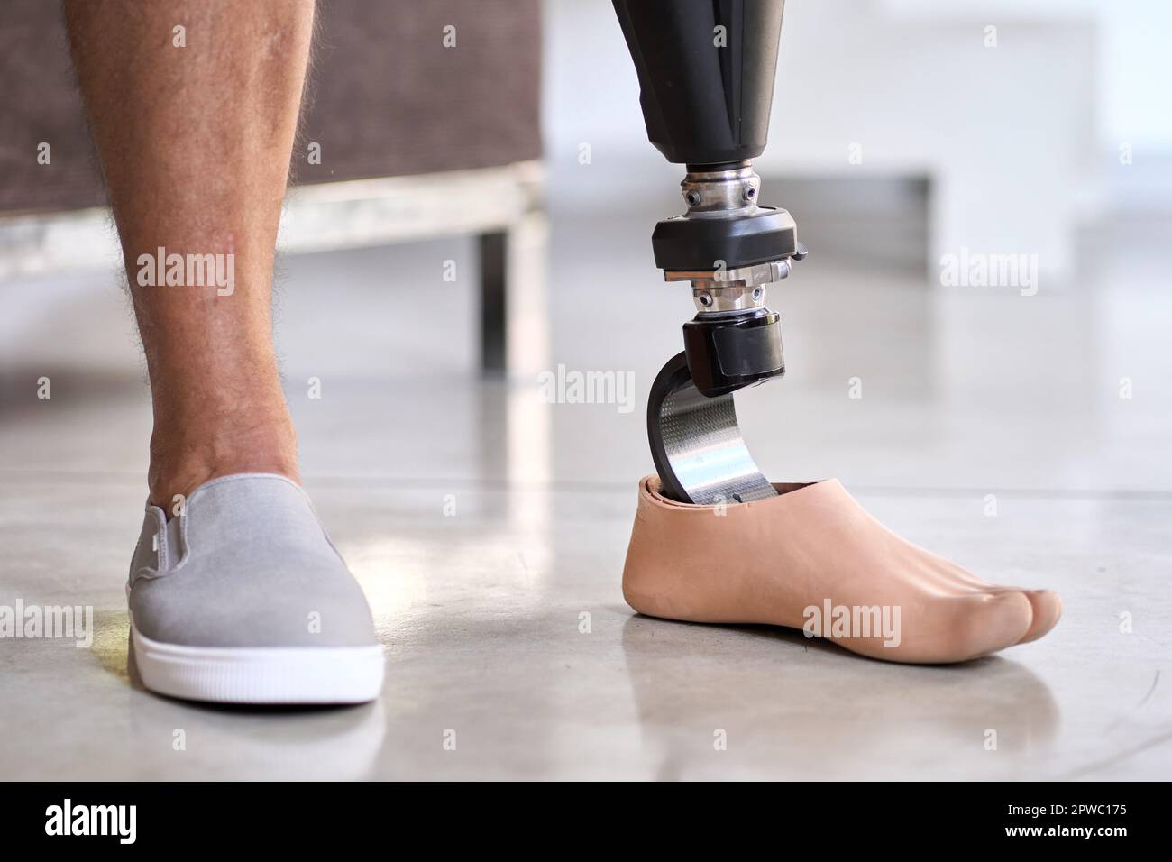 Prothèse amputation au dessus du genou Banque de photographies et d ...