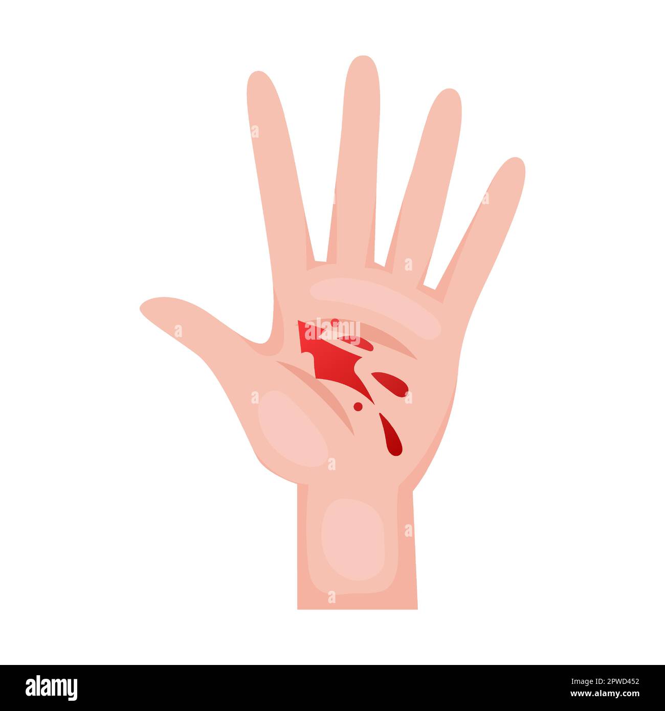 ouvrir la plaie sur la paume de la main. Traumatismes de la peau sur la ...