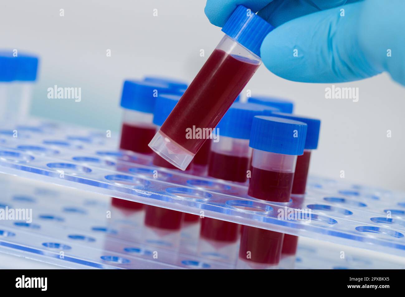 Clínica de análisis de sangre laboratorio clínico Banque de ...