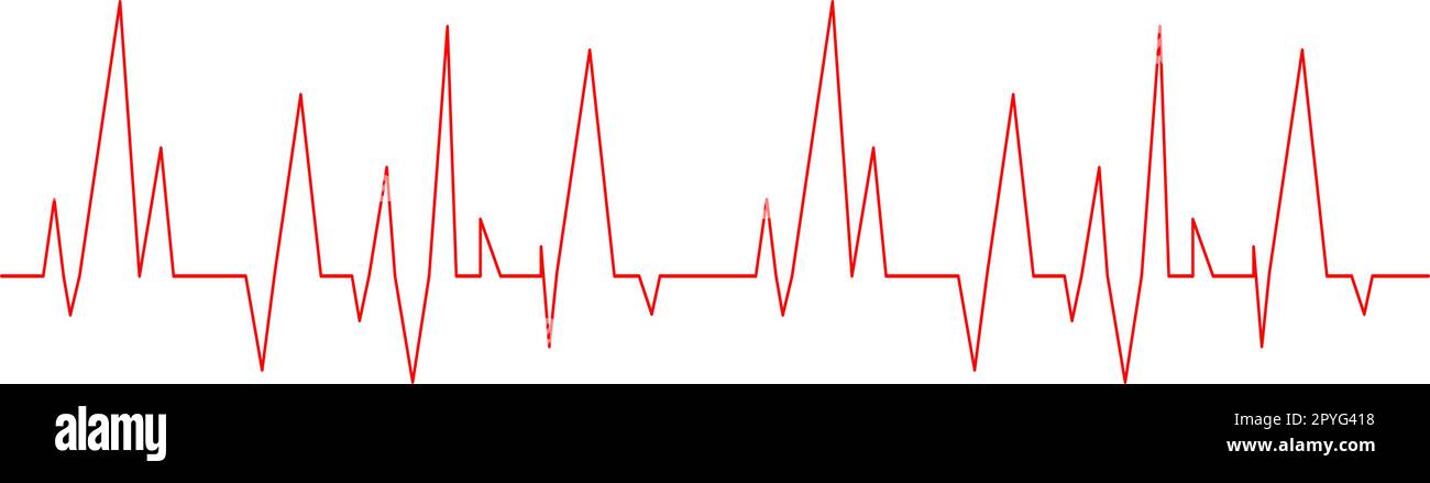 Tableau des battements cardiaques. Diagramme ECG isolé sur fond blanc ...