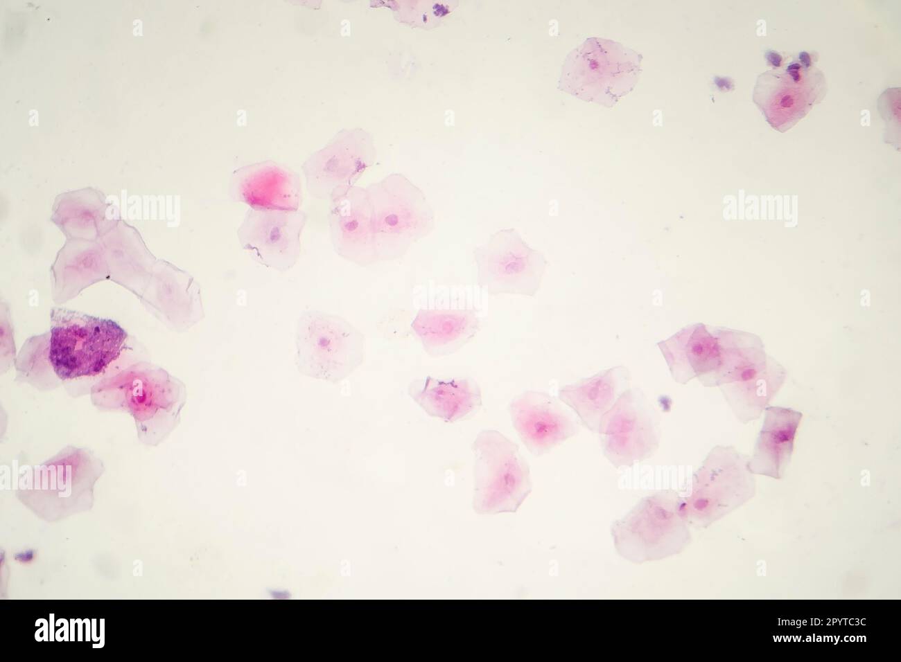 Frottis buccal humain sous microscope montrant des cellules squameuses ...