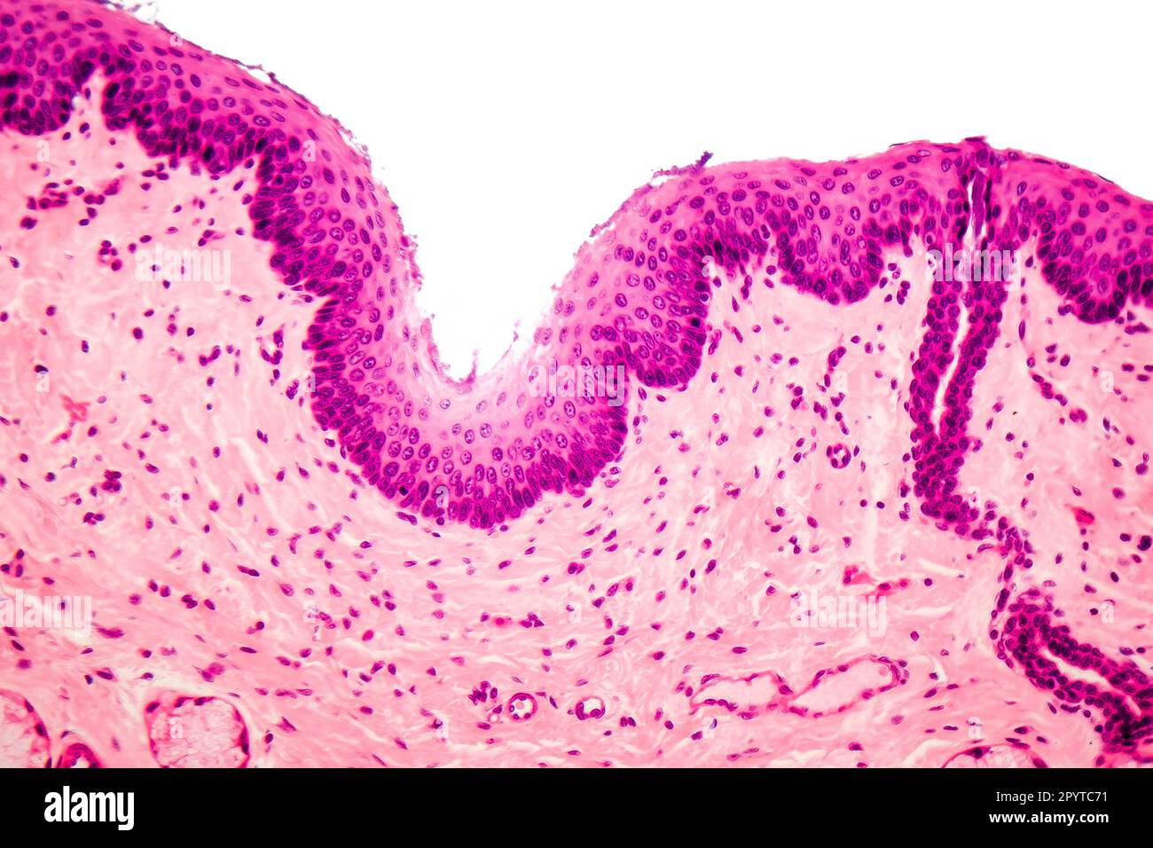 Squamous epithelium Banque de photographies et d’images à haute ...