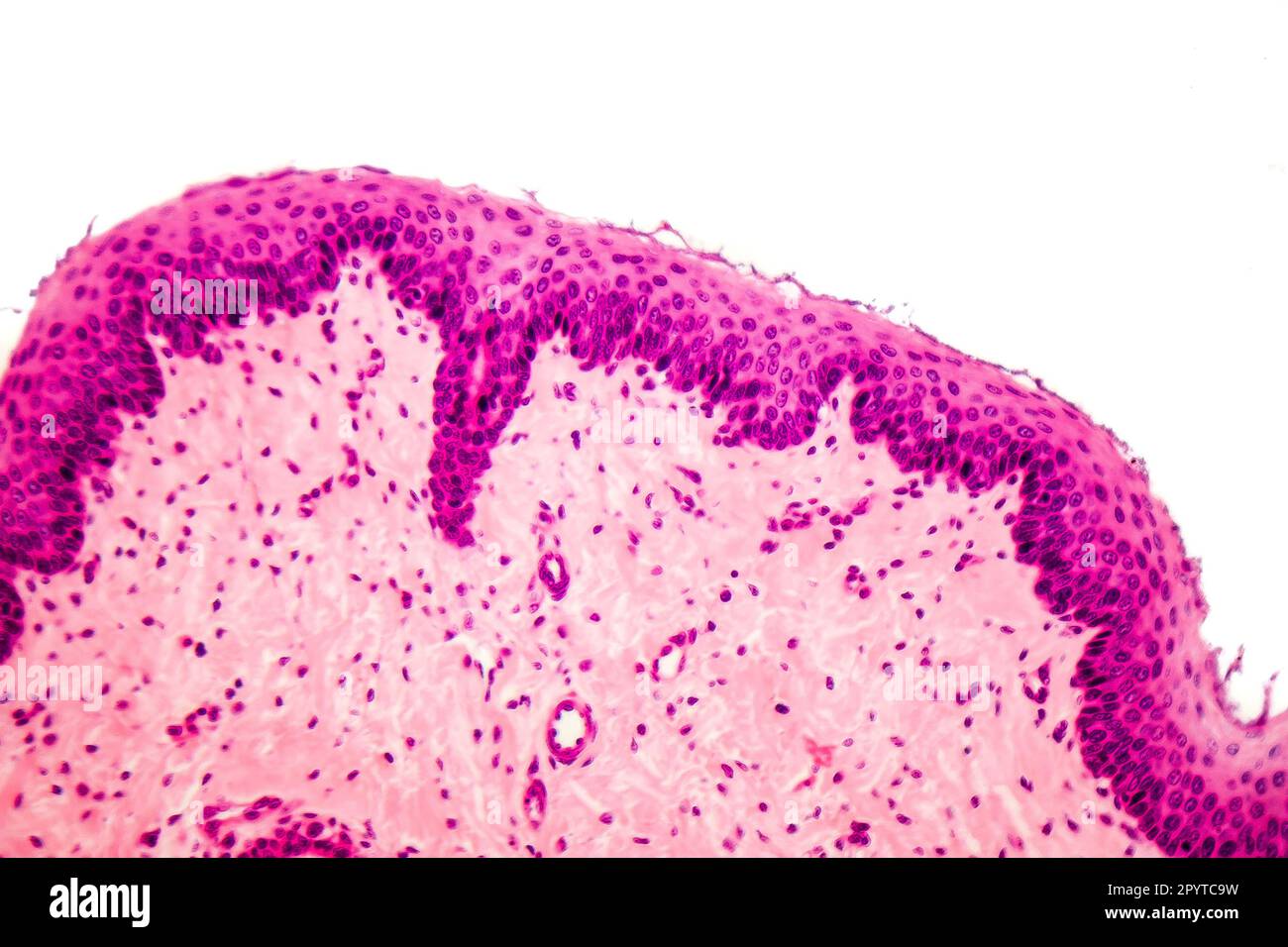 Squamous epithelium Banque de photographies et d’images à haute ...