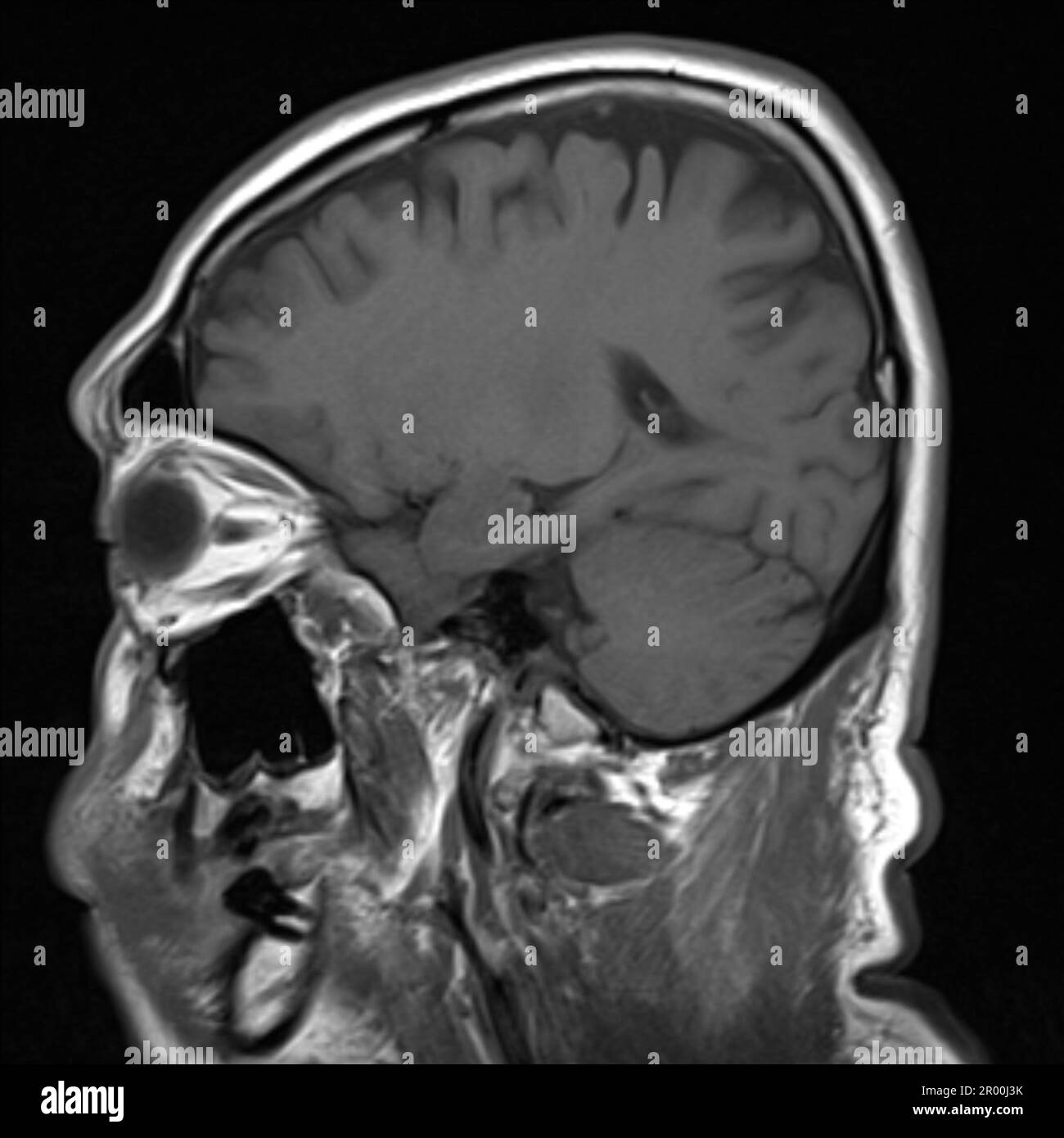 Irm du cerveau humain Banque de photographies et d’images à haute résolution - Alamy
