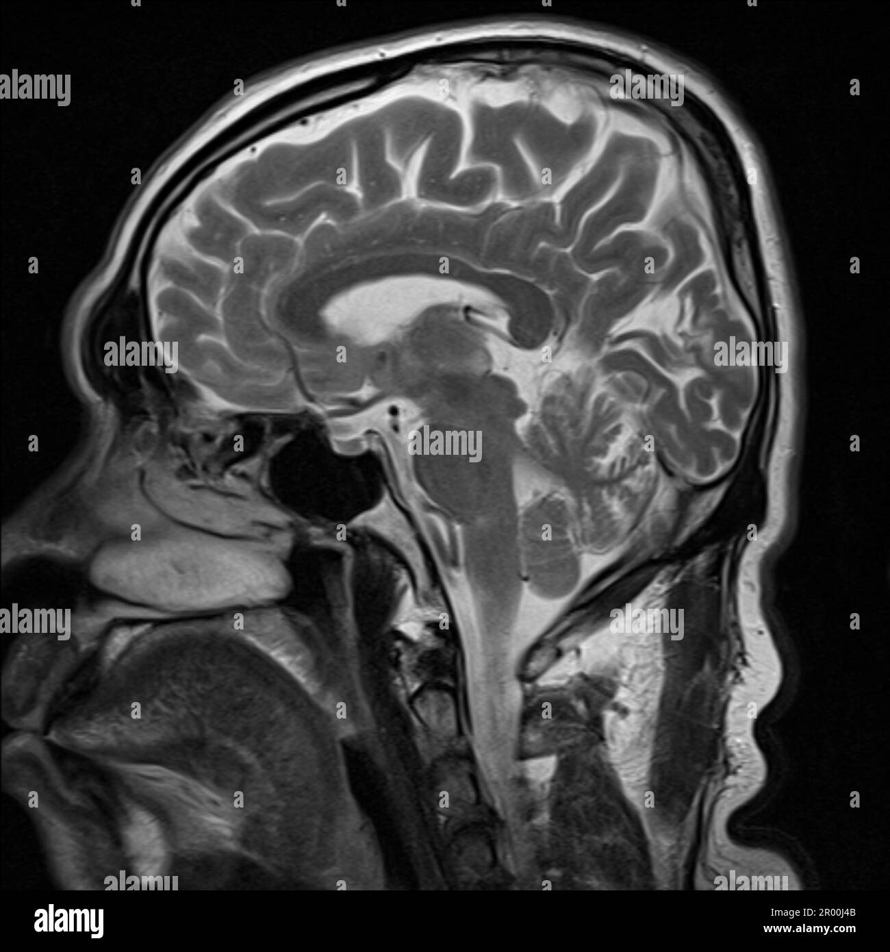 Anatomie normale du corps humain Banque d'images noir et blanc - Page 3 ...