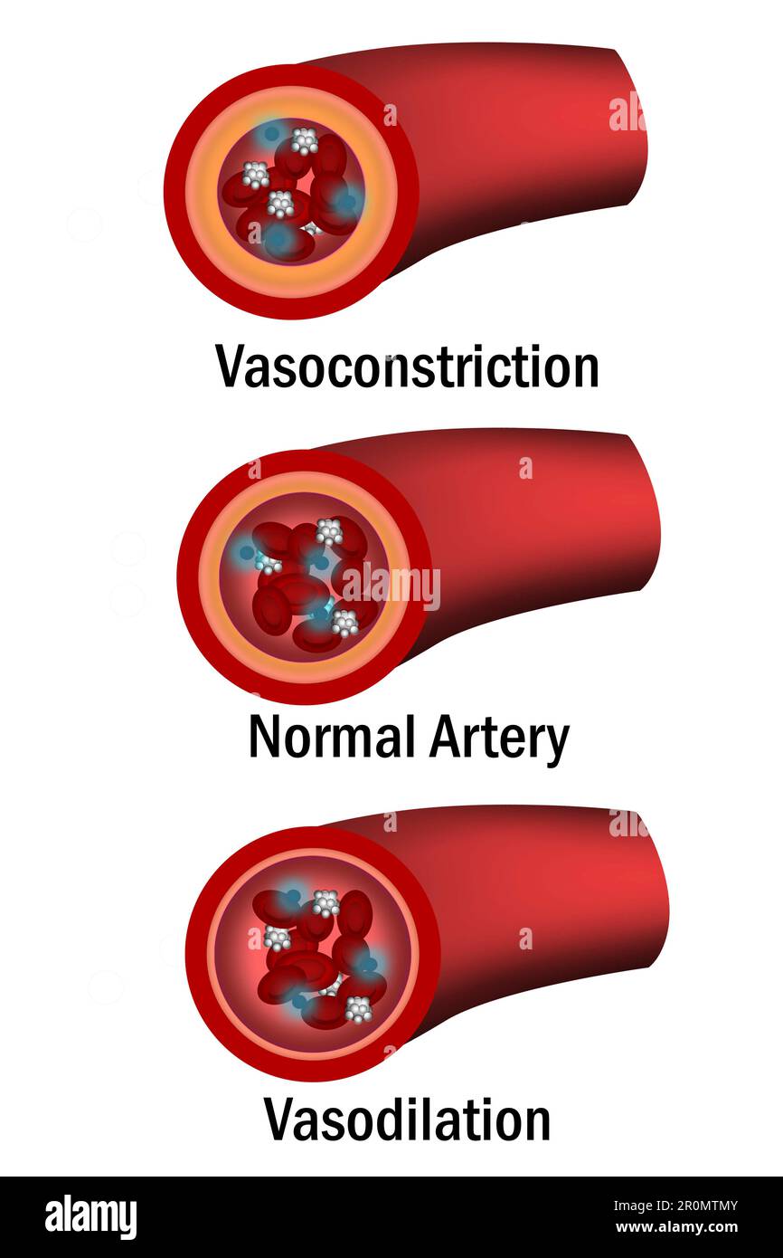 Comparaison des vaisseaux sanguins normaux, vasoconstriction et ...