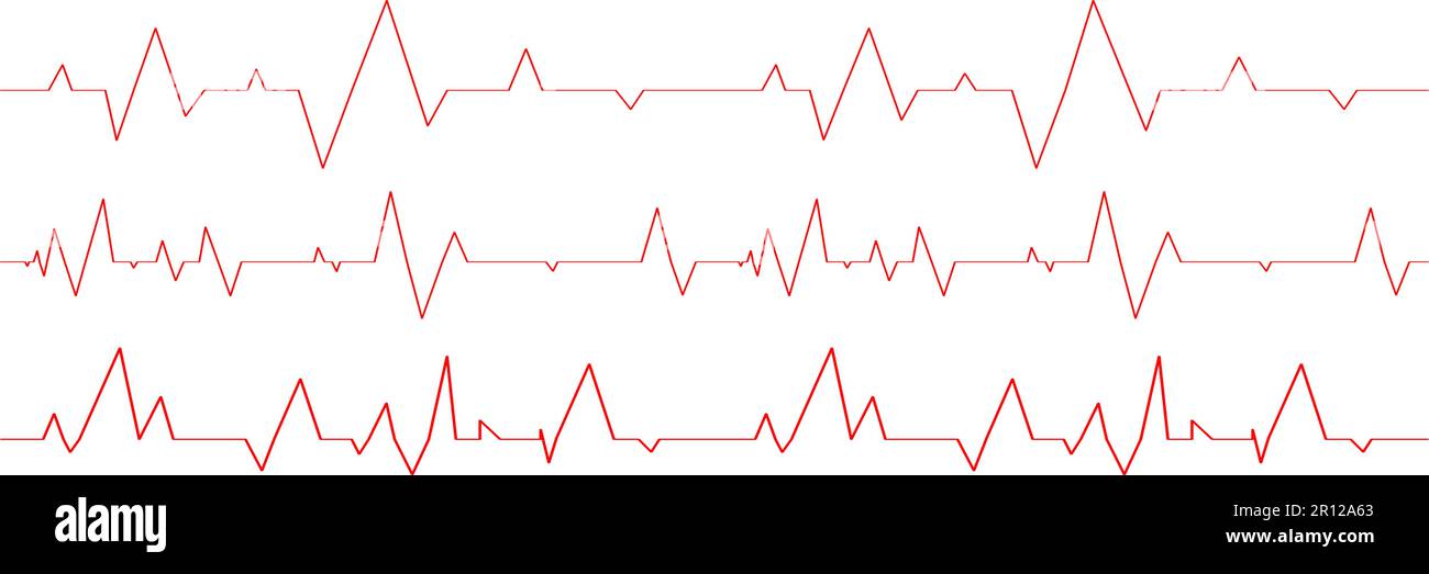 Ensemble de diagrammes de pulsation. Diagrammes ECG isolés sur fond ...