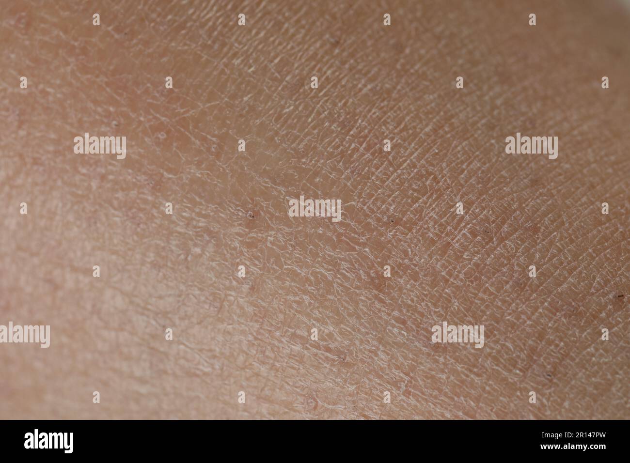 Examen grossier Banque de photographies et d’images à haute résolution ...