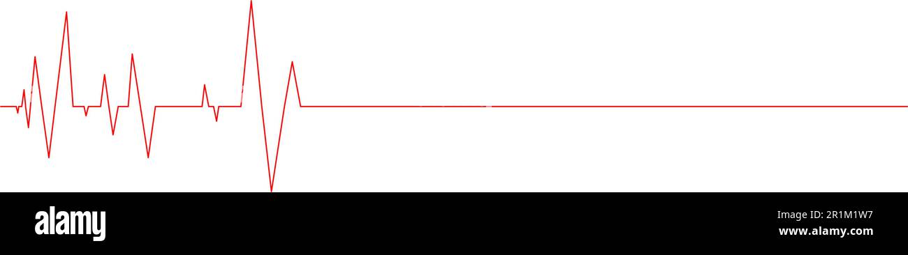 Diagramme de battements cardiaques avec ligne droite. Partie du dossier ...