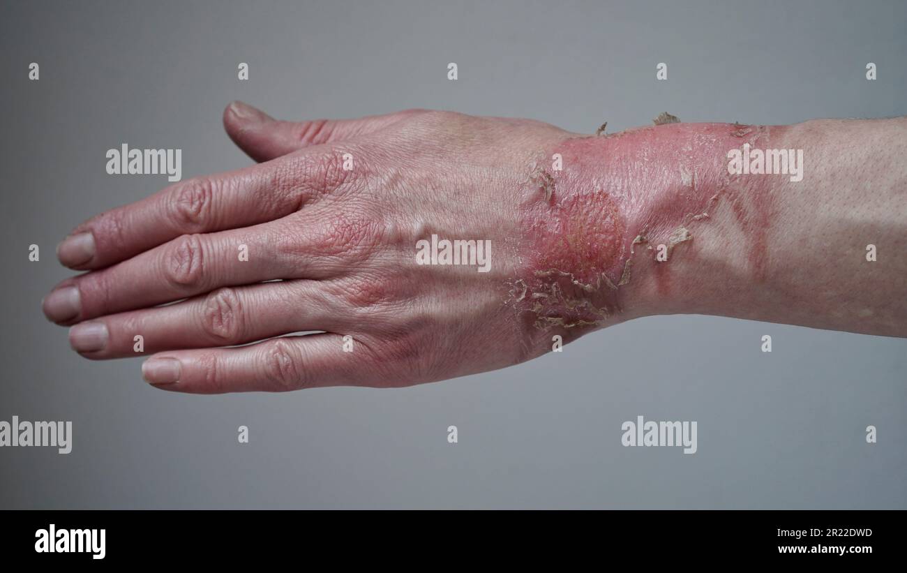 Gros plan de la main d'une femme avec une plaquette éclair provenant d ...