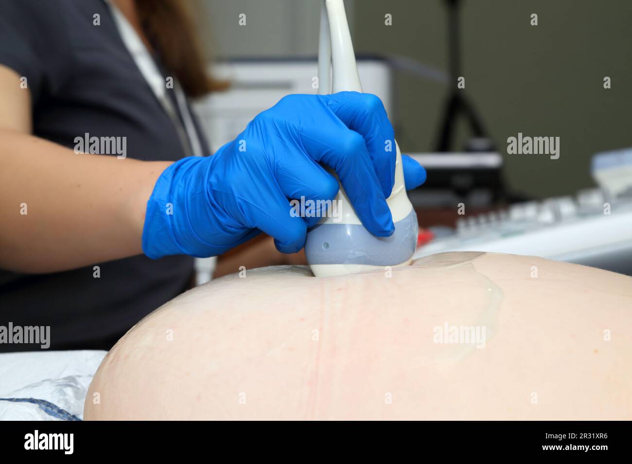 Examen échographique du fœtus d'une femme enceinte. Appareil d ...