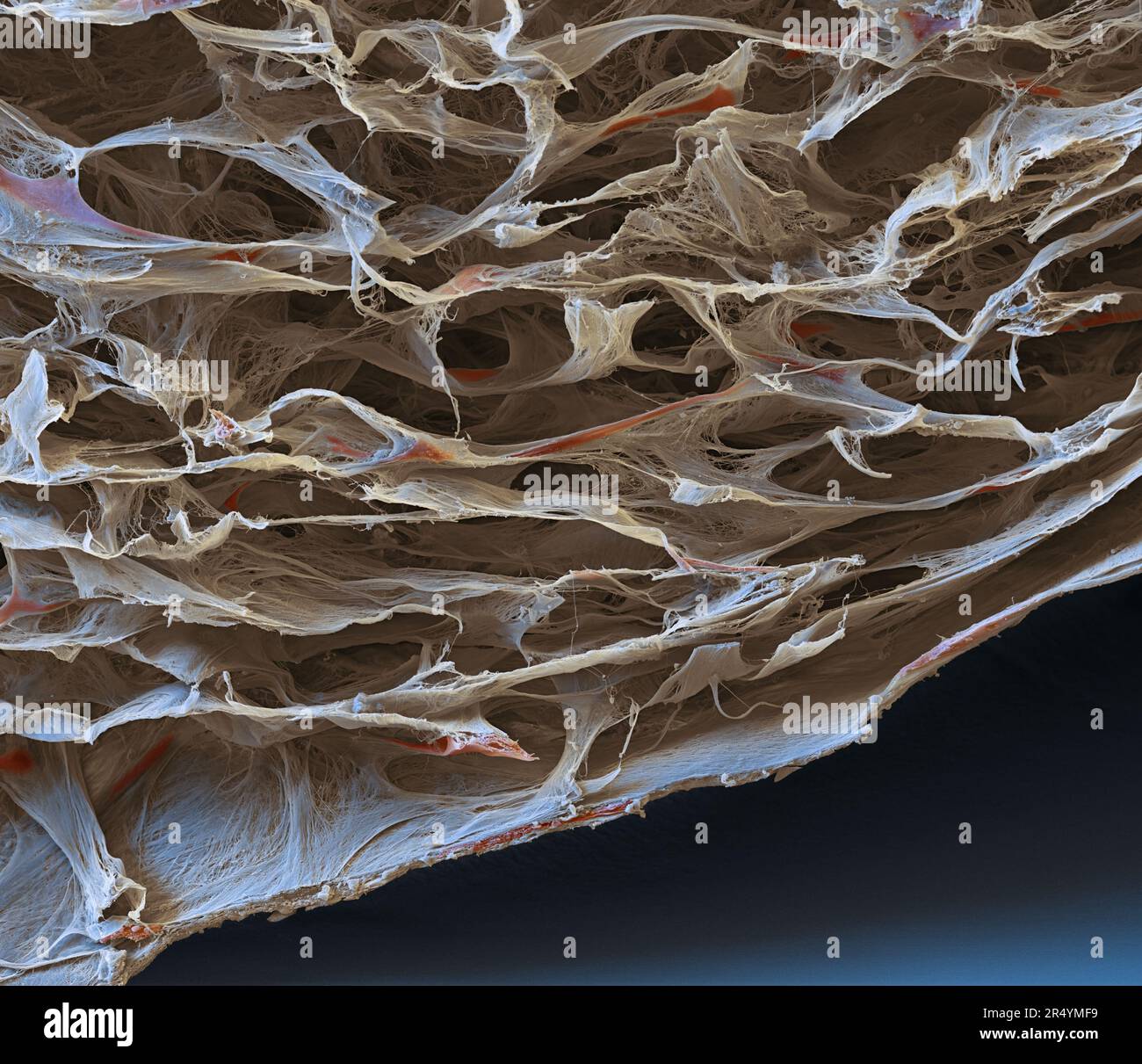 Micrographe électronique à balayage coloré (SEM) d'un réseau de ...