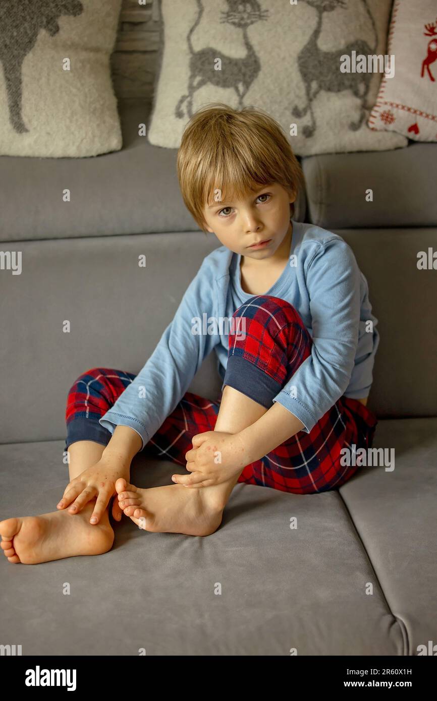 Enfant avec une éruption cutanée, roséola, maladie main-pied-et-bouche ...