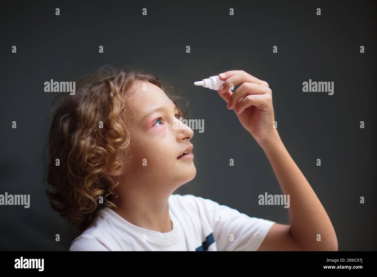 Enfant avec oeil rose gonflé. Infection des yeux et allergie au pollen ...